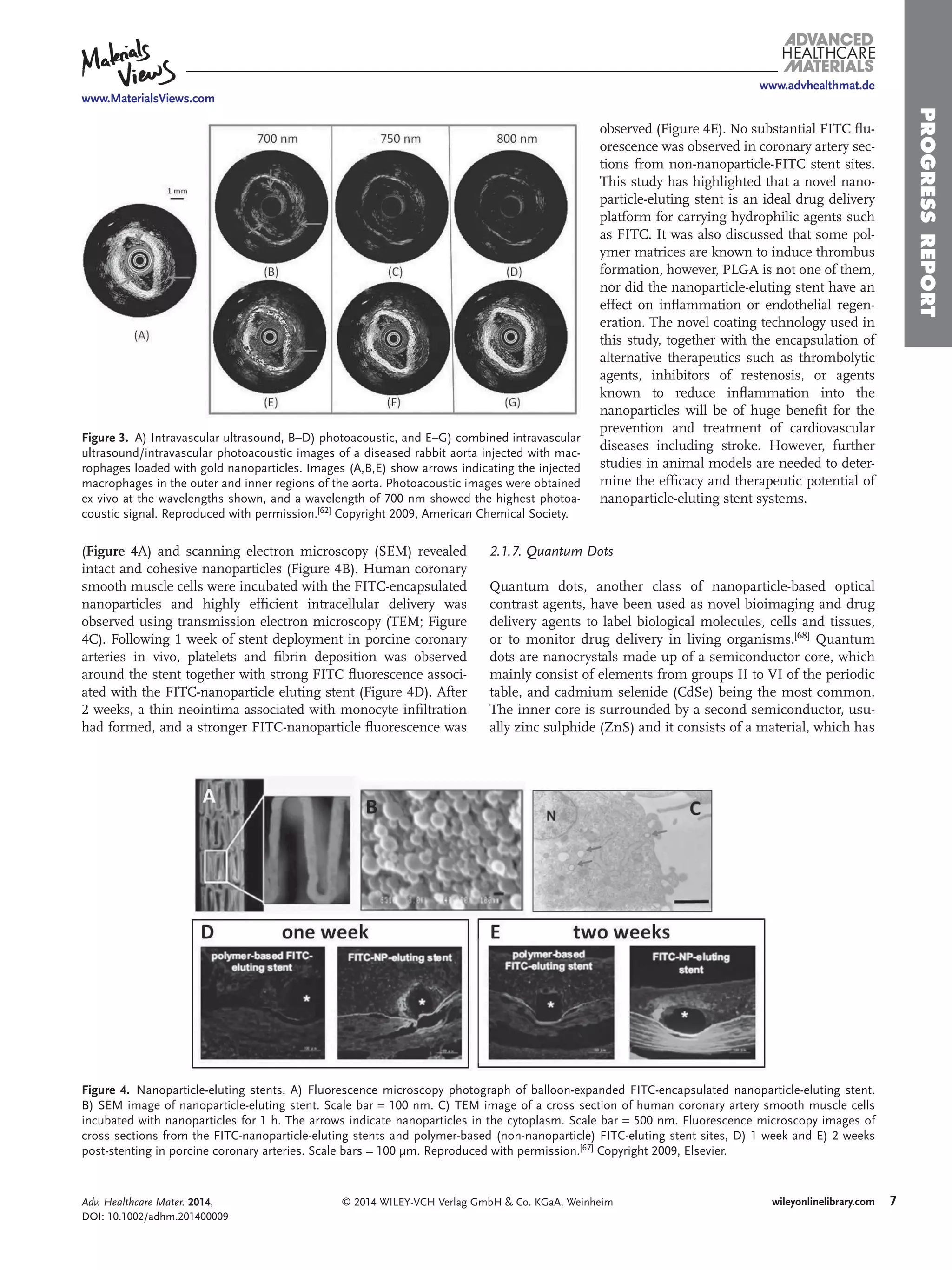 Nanoparticle for stroke | PDF