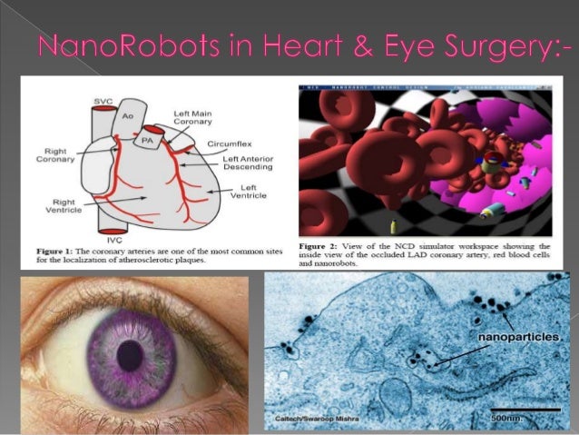 NANOROBO AS A HUMAN IMMUNISER-NANOROBOTICS