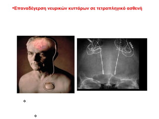Εφαρμογές της Νανοτεχνολογίας στην Ιατρική | PPT