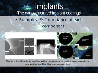 Nanotechnology in dentistry | PPTX