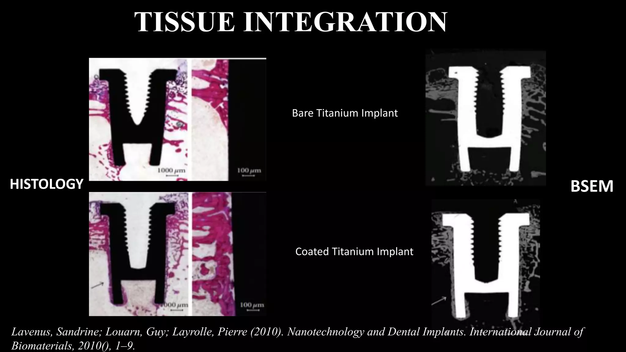 Nanotechnology in surface modification of implants | PPTX