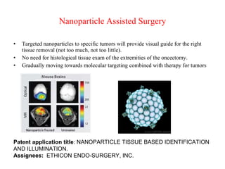 Nanotechnology in surgery | PPT