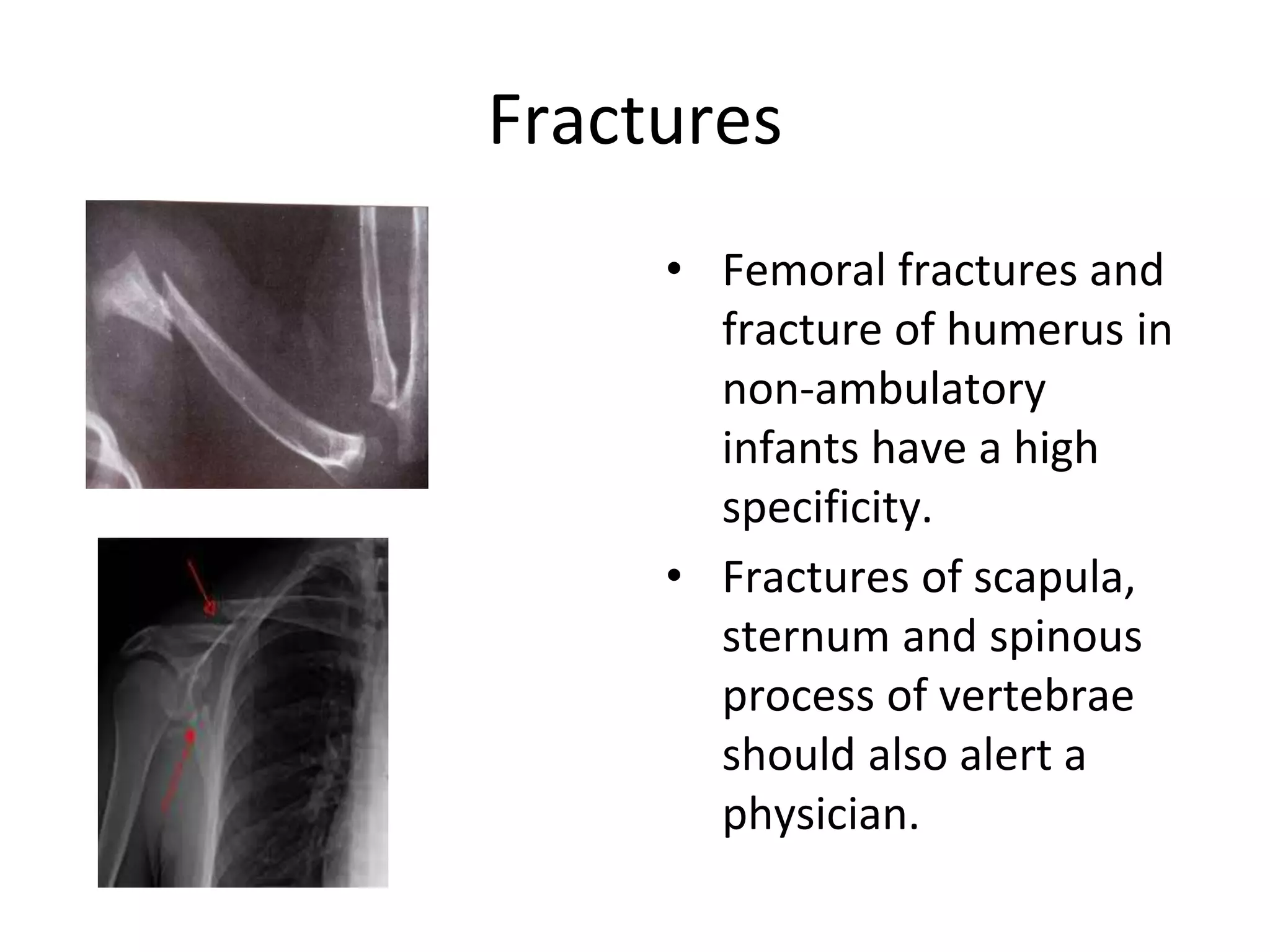 NAPCON- SAVE EVERY CHILD -POLYTRAUMA.pptx