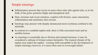 Napkin dermatitis Dr Sandeep Lal V | PPTX