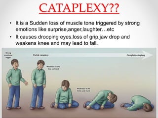 NARCOLEPSY | PPTX