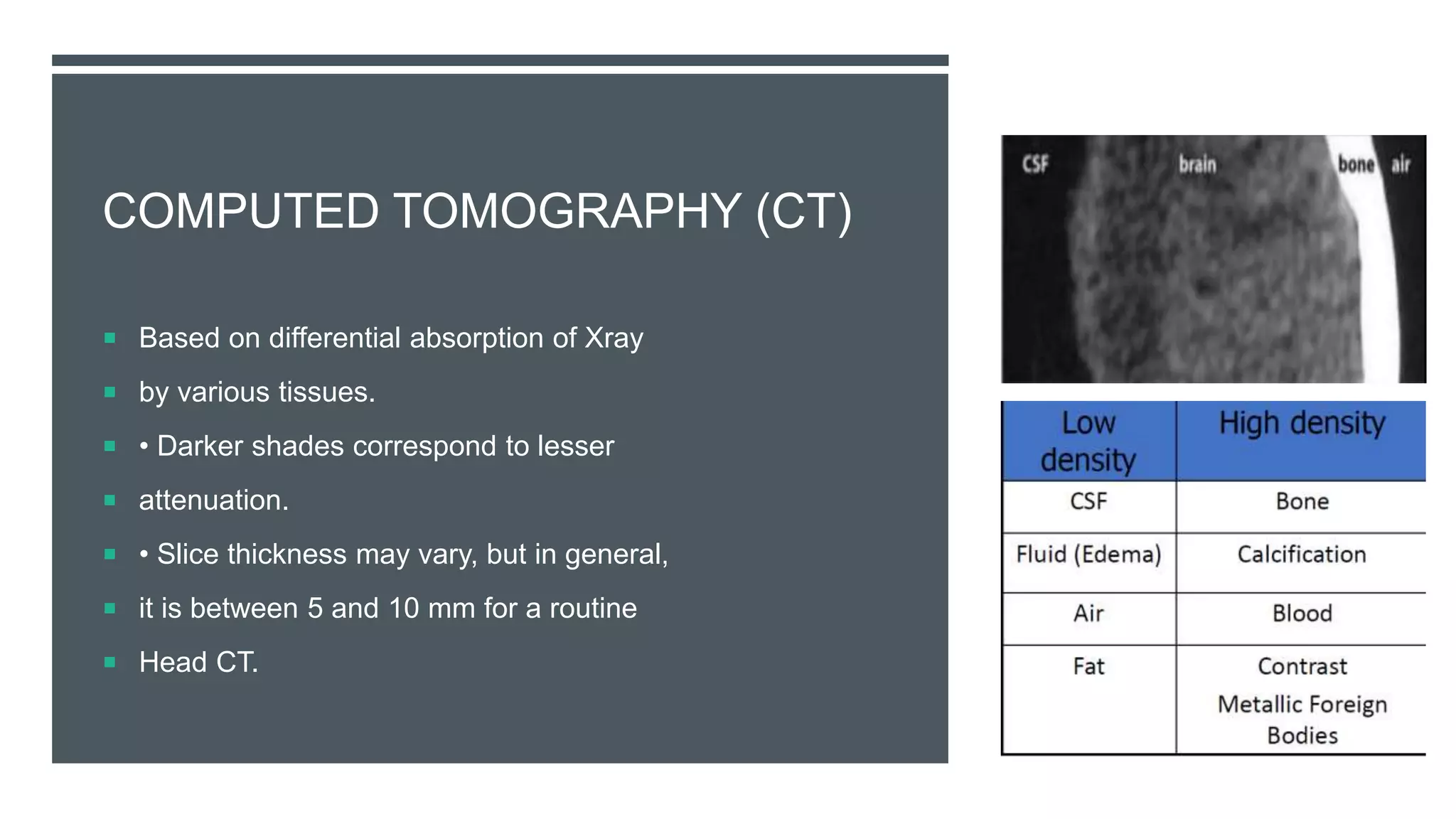 clinical application of CT/ MRI | PPTX