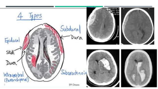 clinical application of CT/ MRI | PPTX