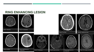 clinical application of CT/ MRI | PPTX