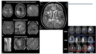 clinical application of CT/ MRI | PPTX