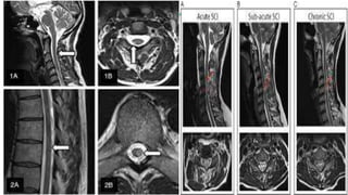 clinical application of CT/ MRI | PPTX