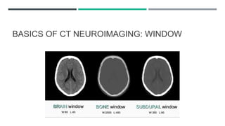 clinical application of CT/ MRI | PPTX