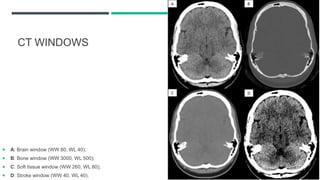 clinical application of CT/ MRI | PPTX
