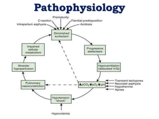 NEONATAL RESPIRATORY DISTRESS SYNDROME | PPTX