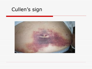 Naresh kumar final | PPT