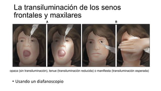 Nariz, nasofaringe y senos | PPTX