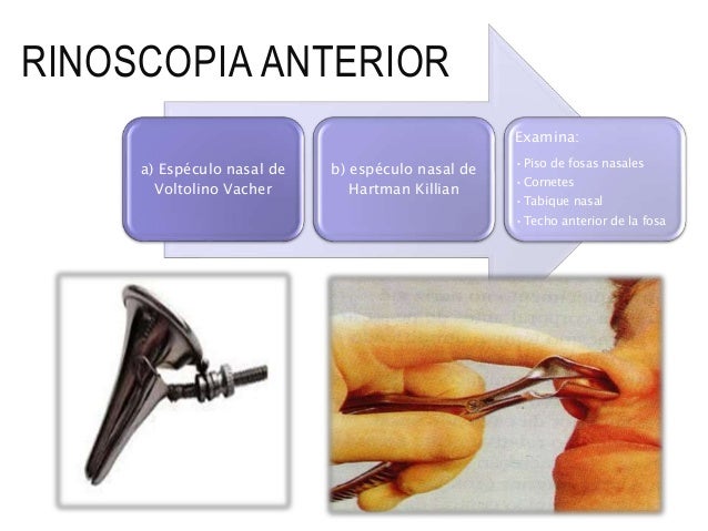 Nariz y senos paranasales (Otorrinolaringologia)