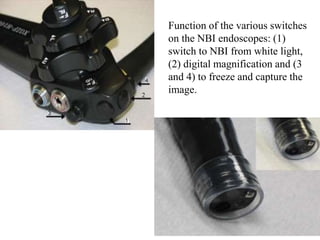 Narrow band imaging | PPTX