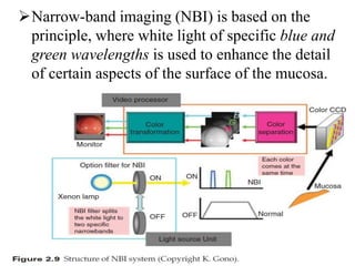 Narrow band imaging | PPTX