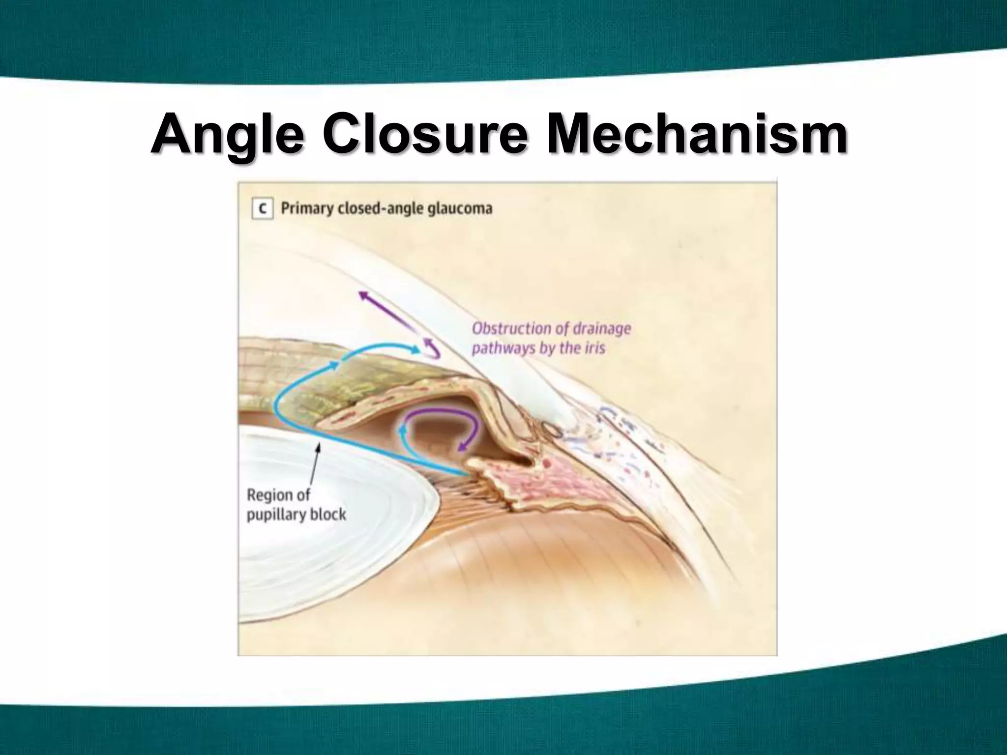 Narrow angles talk | PPTX