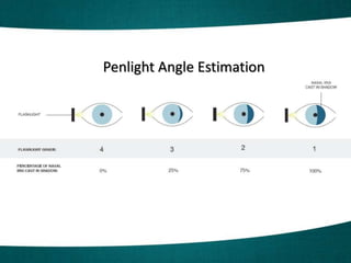 Narrow angles talk | PPT