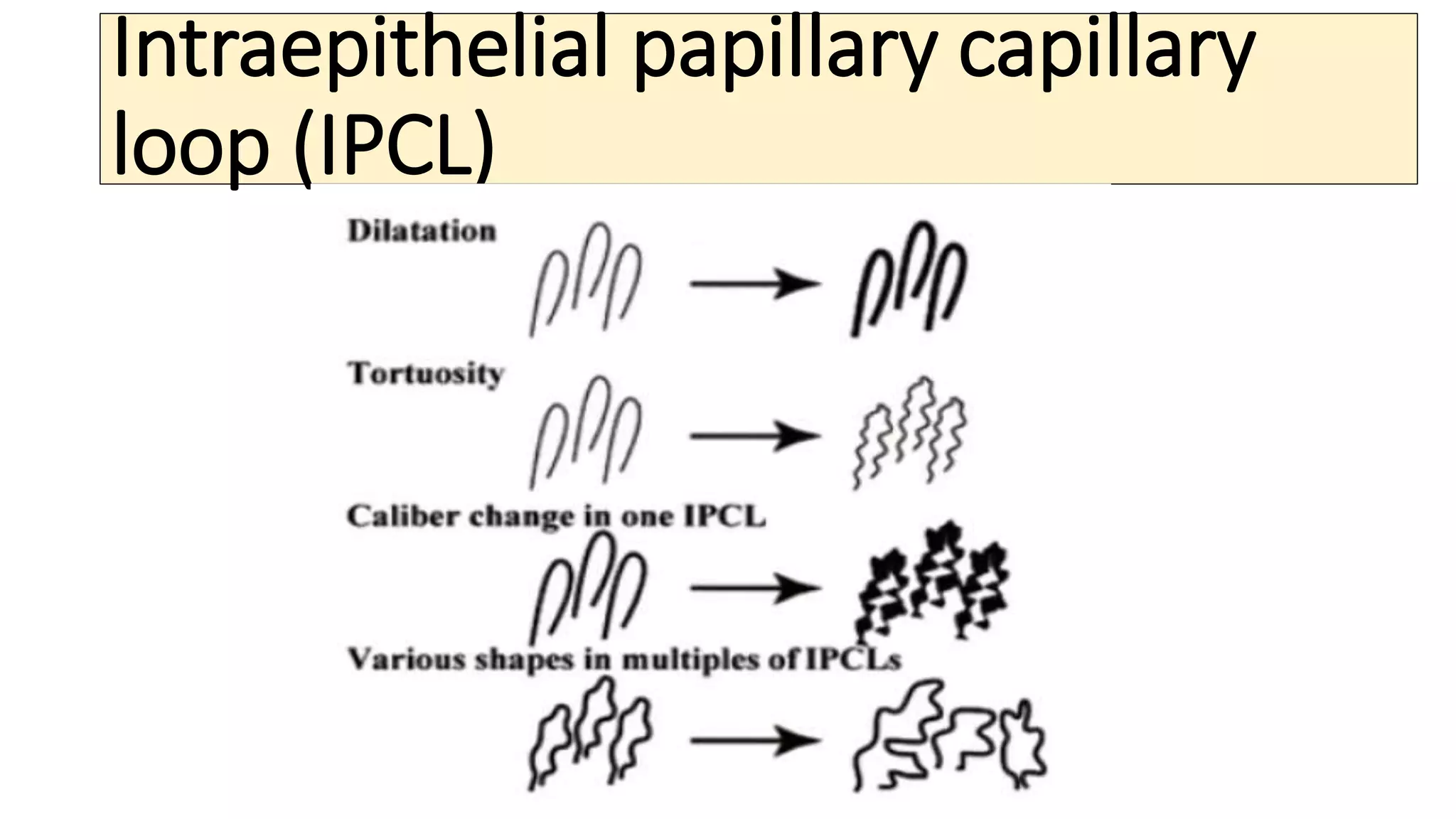 Narrow band imaging | PPTX
