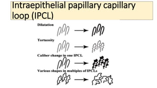 Narrow band imaging | PPTX