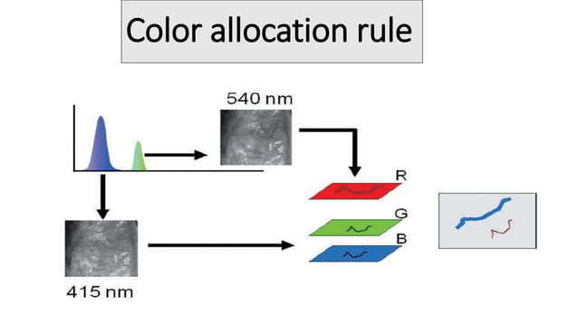 Narrow band imaging | PPTX