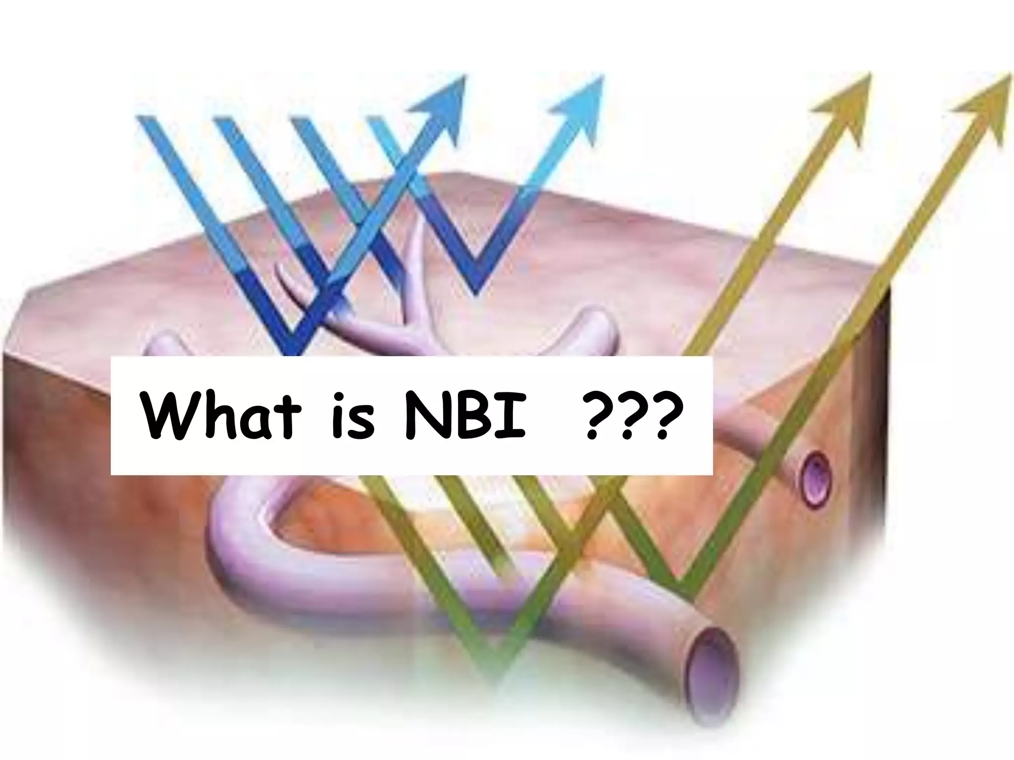 Narrow band imaging(nbi) in ent -Dr.Ashly Alexander | PPTX