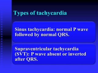 Narrow complex tachycardia | PPSX