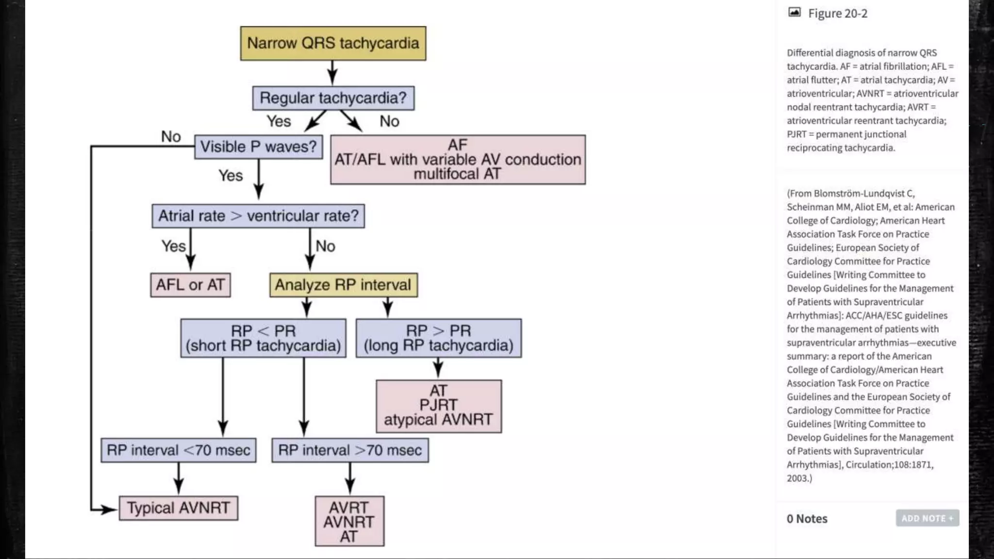 Approach to Narrow complex tachycardia | PPTX