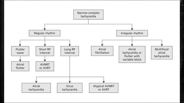 Approach to Narrow complex tachycardia | PPTX