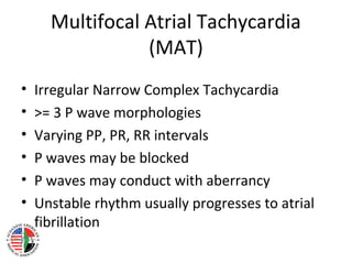 Narrow complex tachycardias | PPT