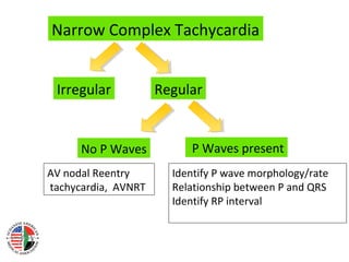 Narrow complex tachycardias | PPT