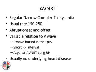 Narrow complex tachycardias | PPT