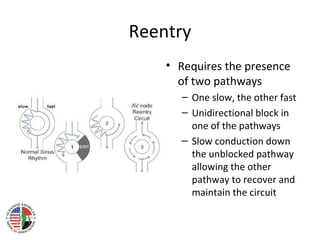 Narrow complex tachycardias | PPT