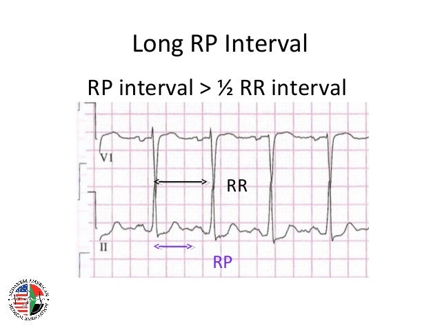 Narrow complex tachycardias