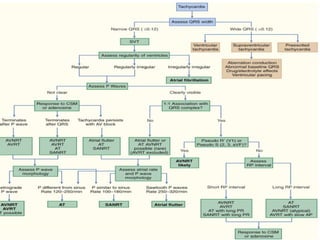 Narrow QRS Tachycardia | PPT