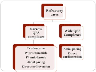 Narrow Qrs Complex