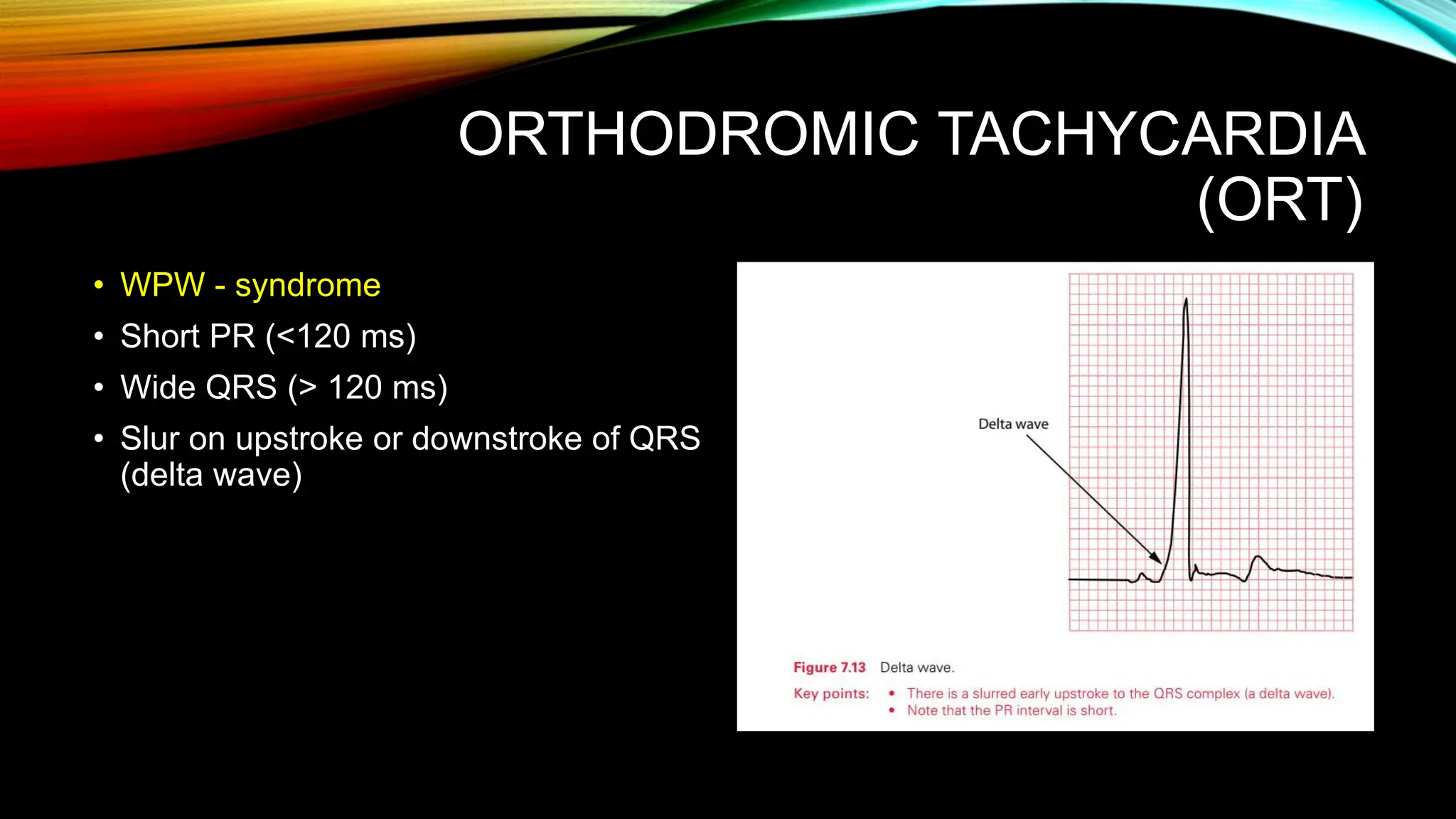 Narrow QRS Tachycardia diagnosis and treatment.pptx