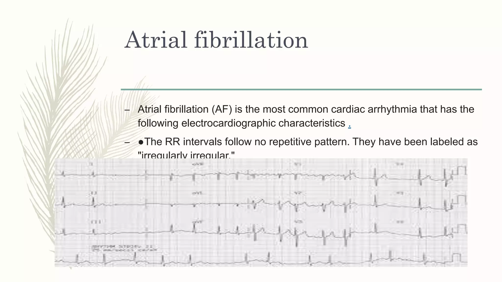 Narrow qrs tachycardia part 1 | PPT