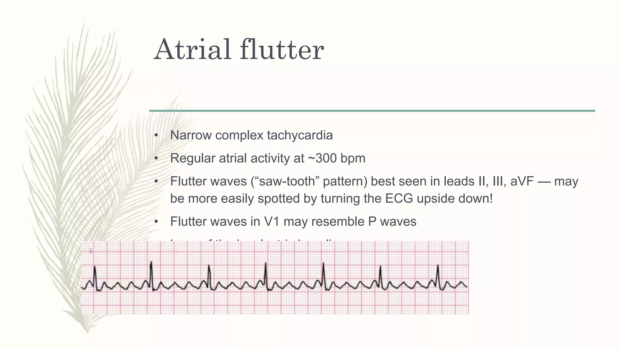 Narrow qrs tachycardia part 1 | PPT