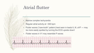 Narrow qrs tachycardia part 1 | PPT
