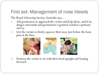 Nasal Fractures | PPT