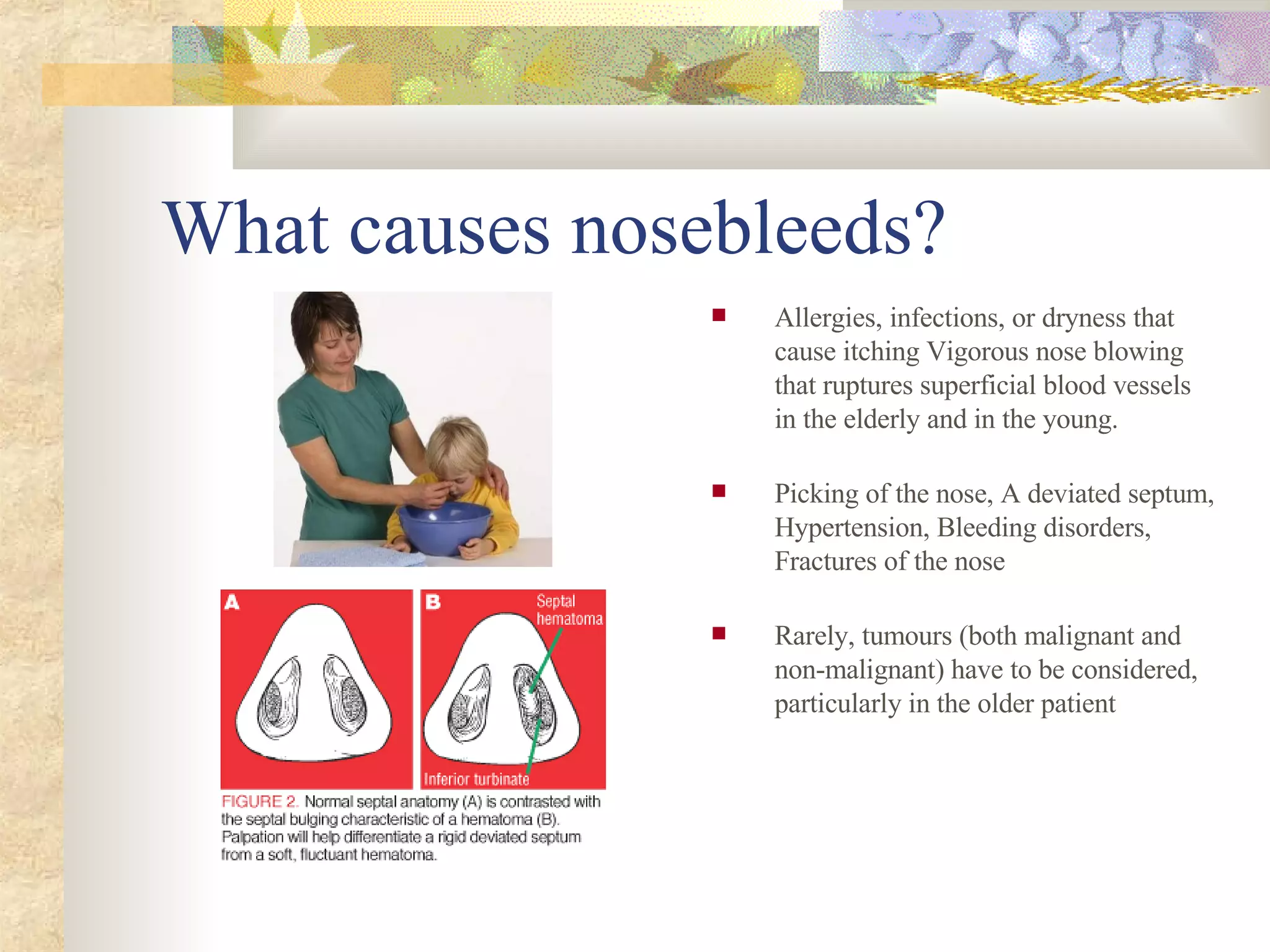 Nasal Injuries | PPT
