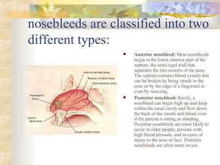 Nasal Injuries | PPT