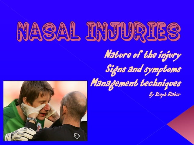 Nasal Injuries Ppt