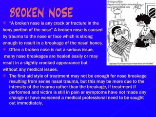 Nasal Injuries | PPT