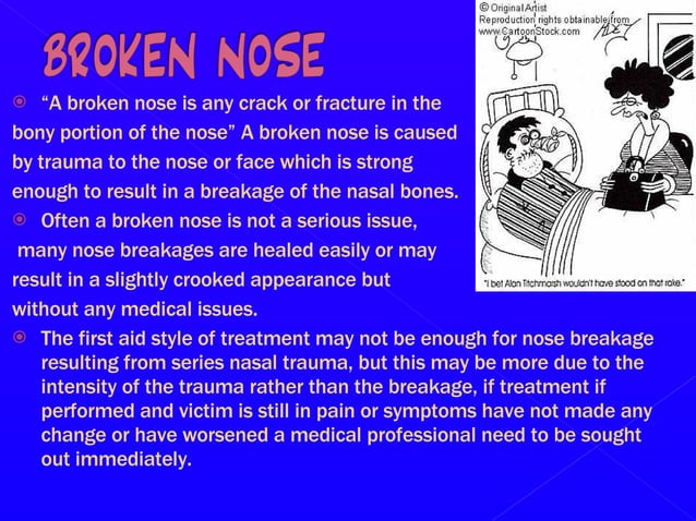 Nasal Injuries | PPT | First Aid | Injuries
