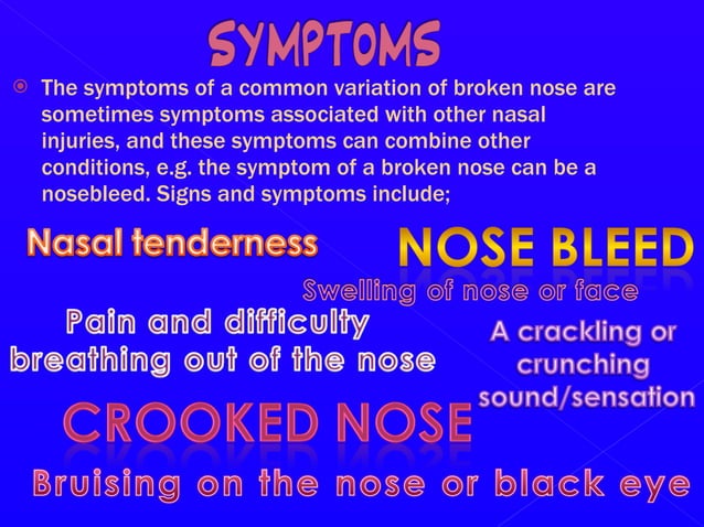 Nasal Injuries Ppt