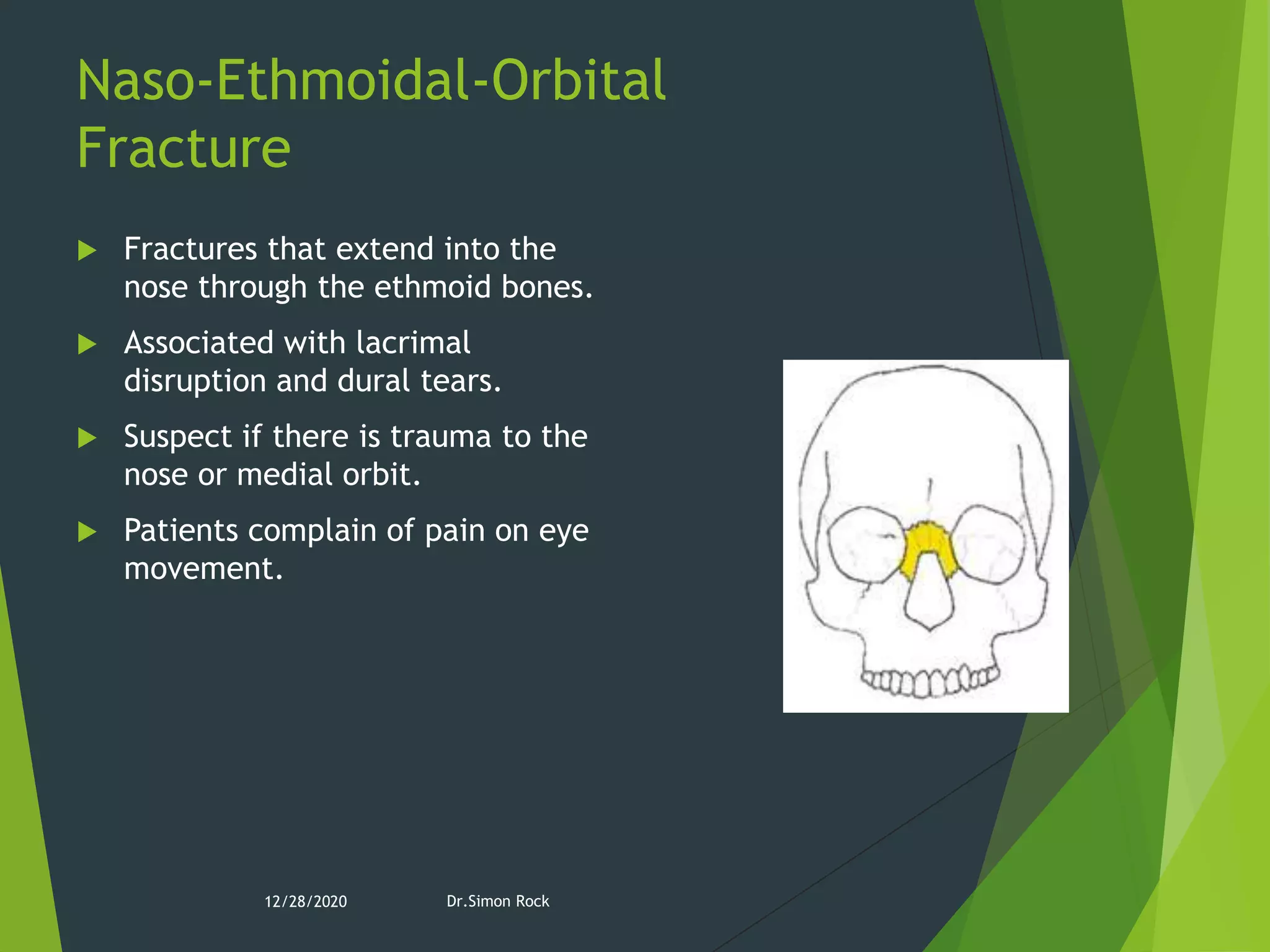 Nasal orbital-ethmoid (noe) fractures | PPT